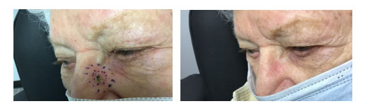 IG-SRT Treatment Centers in Belleville, Hillsborough, Newton, and ...